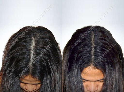 TRX2® Molecular Food Supplement for Hair - Oxford Biolabs