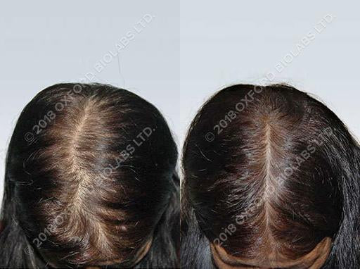 TRX2® Molecular Food Supplement for Hair - Oxford Biolabs